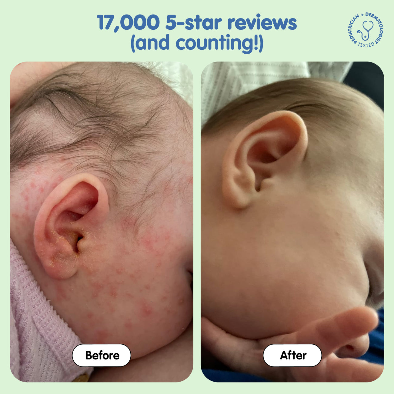 All Over Ointment 1% Colloidal Oatmeal | Tubby Todd Bath Co.